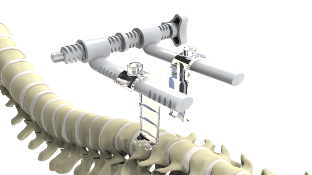 SURE to showcase open and mini-open sterile and single-use retractor ...